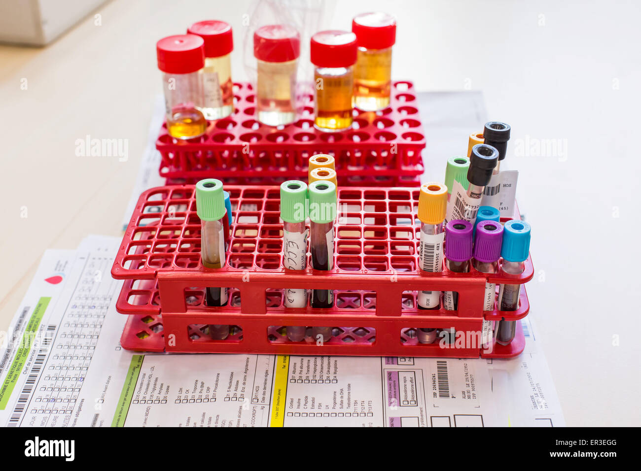 Urine analysis in laboratory Stock Photo - Alamy