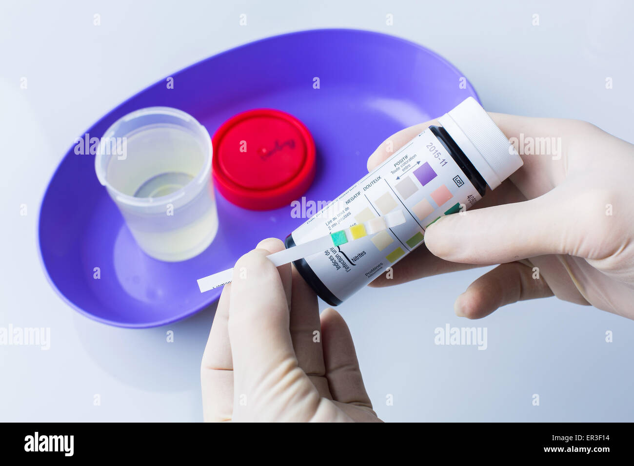 Urine sample with a test strip showing the results. This urine analysis ...