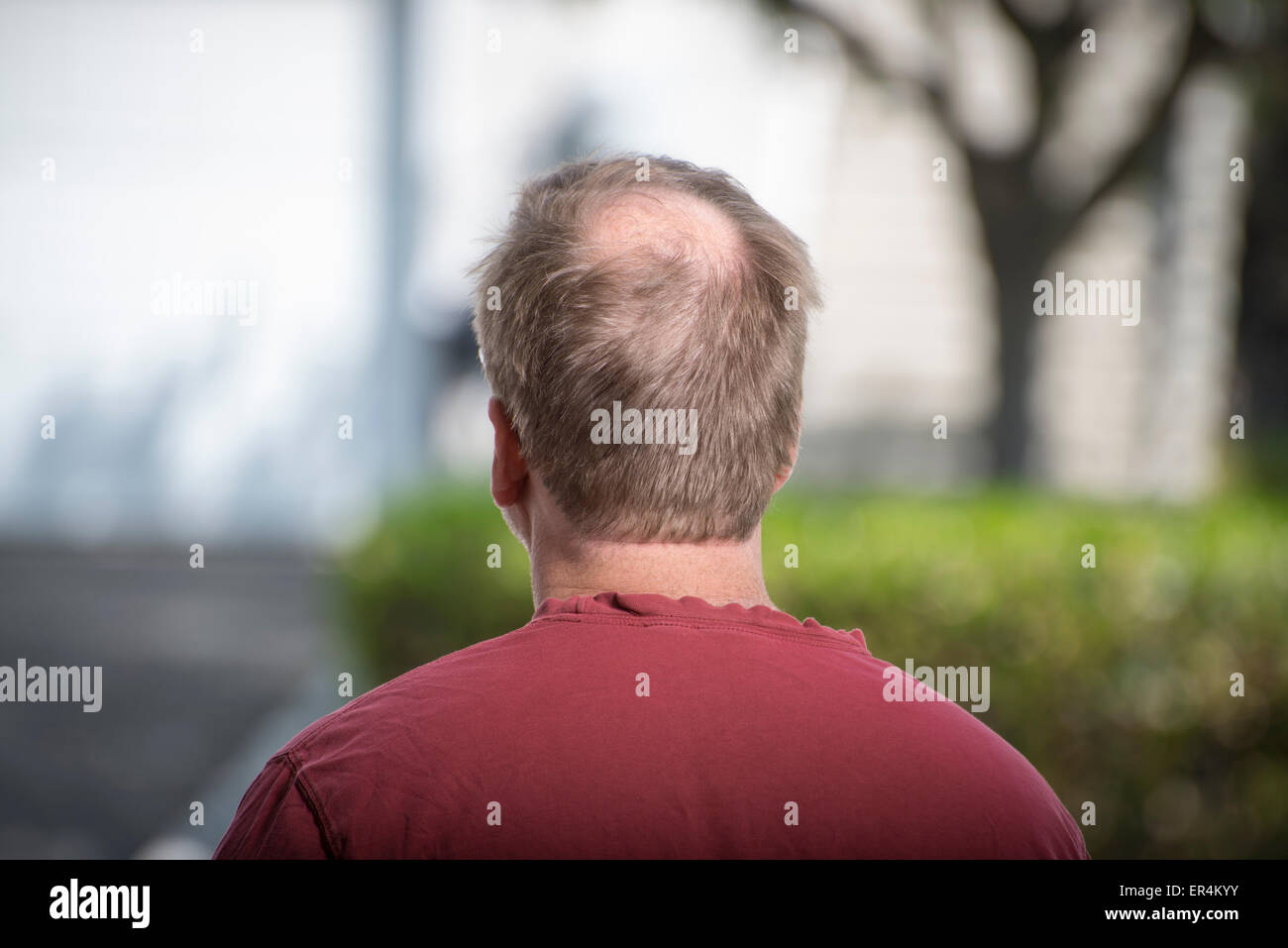 Back Of Balding Guy's Head Stock Photo - Alamy