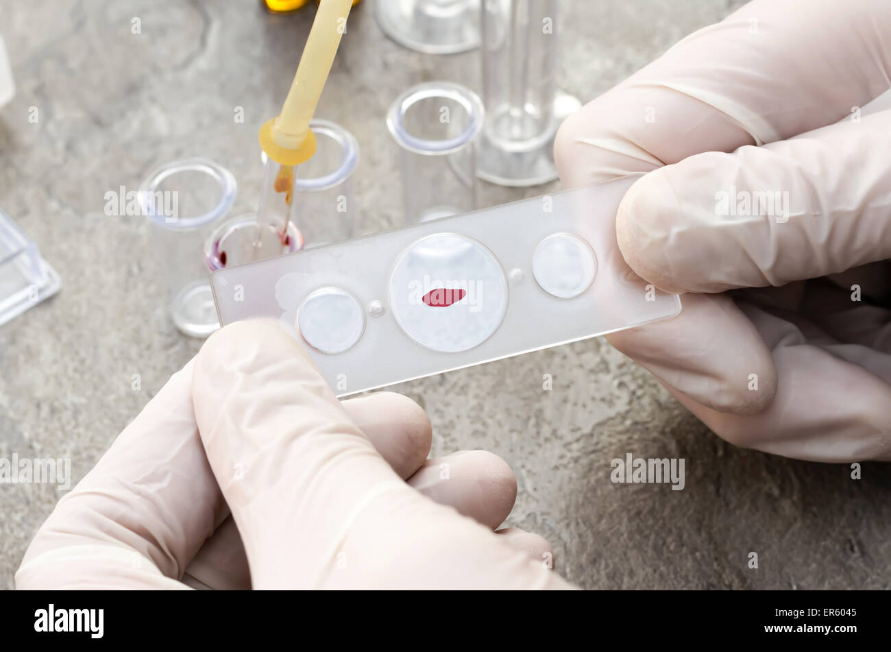 Blood test and experimental research in laboratory Stock Photo - Alamy
