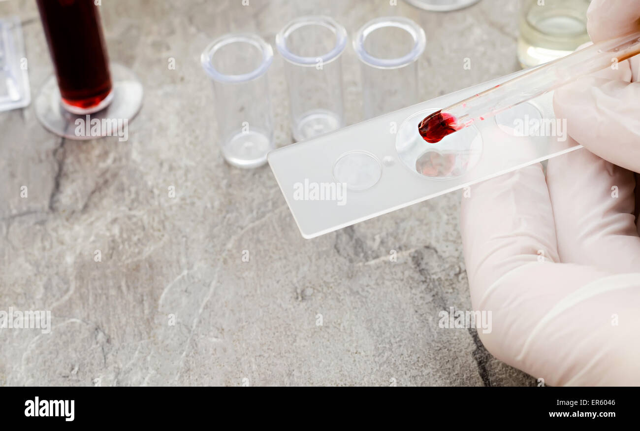 Lab technician chemical blood test hi-res stock photography and images ...