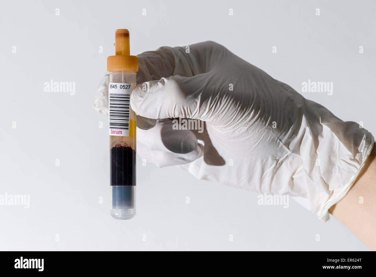 Laboratory assistant's hand holding a monovette containing serum ...