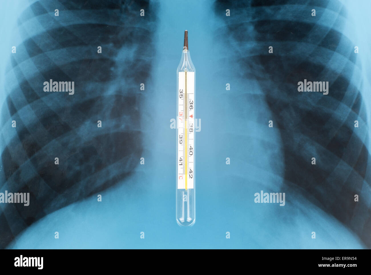 X-ray examination and thermometer Stock Photo - Alamy