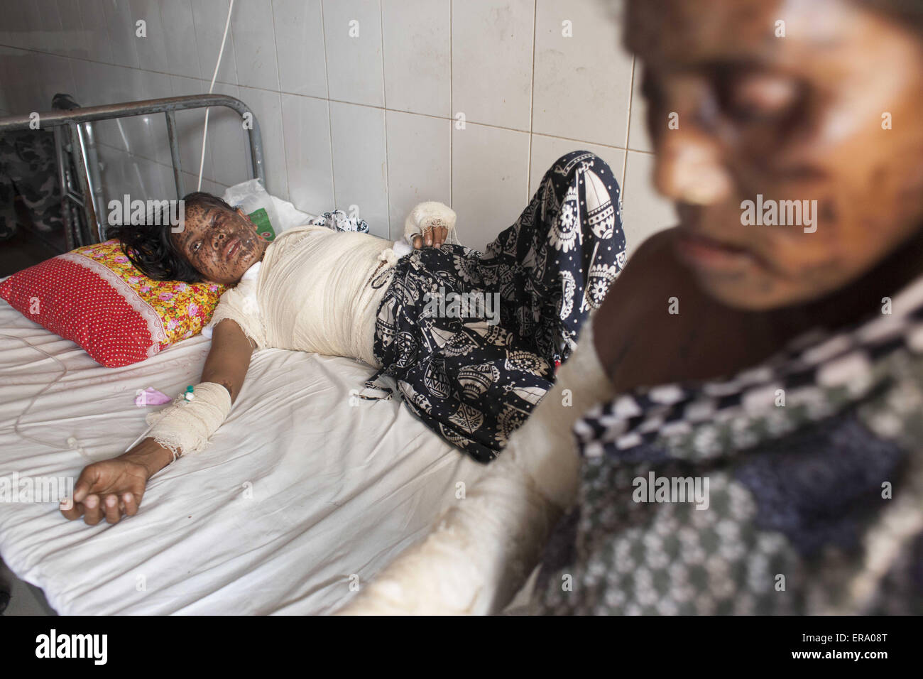 Dhaka, Bangladesh. 30th May, 2015. Sabikun Nahar, 25, suffering from ...