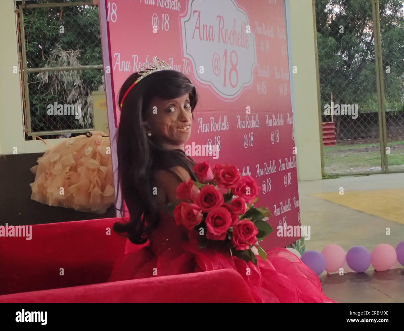 Ana Rochelle Pondare, the girl with rare ageing condition known as ...