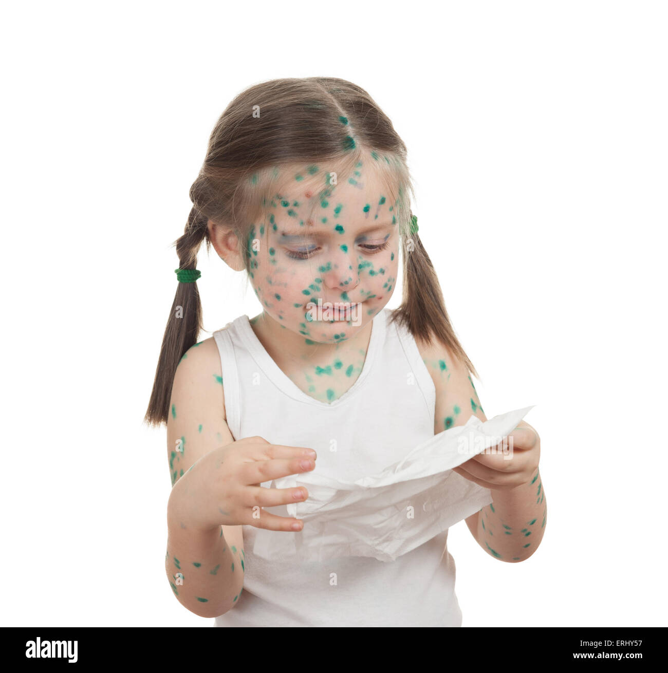 Child chickenpox hi-res stock photography and images - Alamy