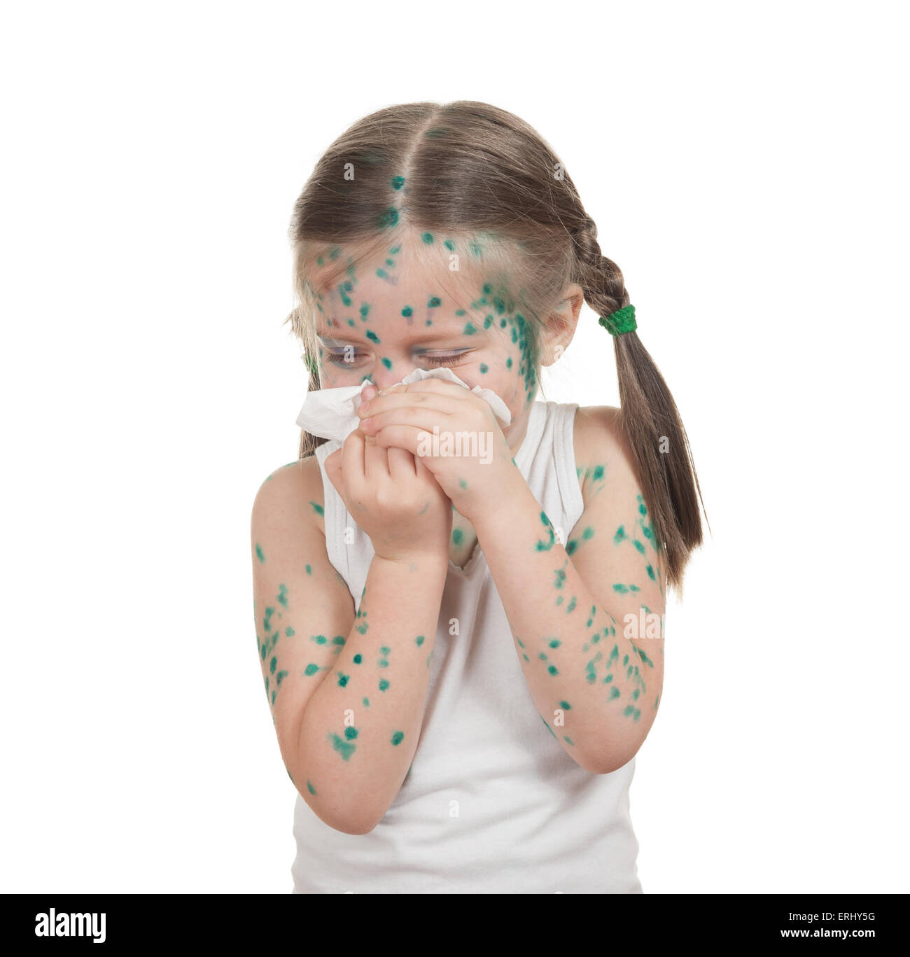 sick child. chickenpox. isolated Stock Photo - Alamy