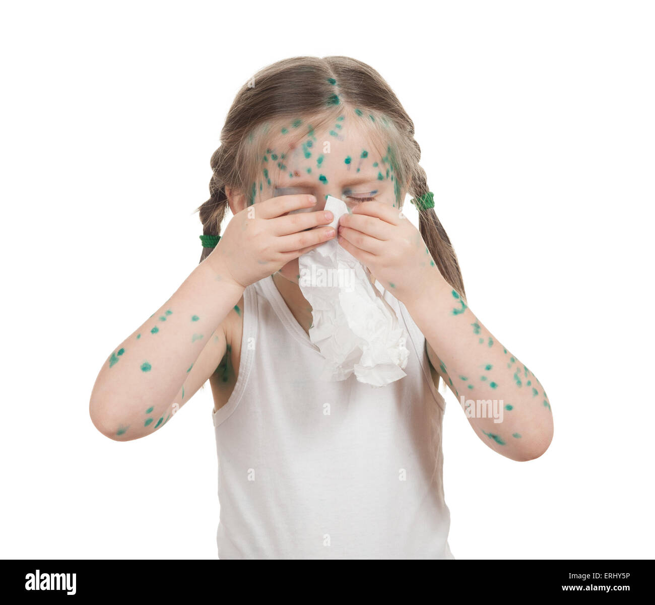 sick child. chickenpox. isolated Stock Photo - Alamy