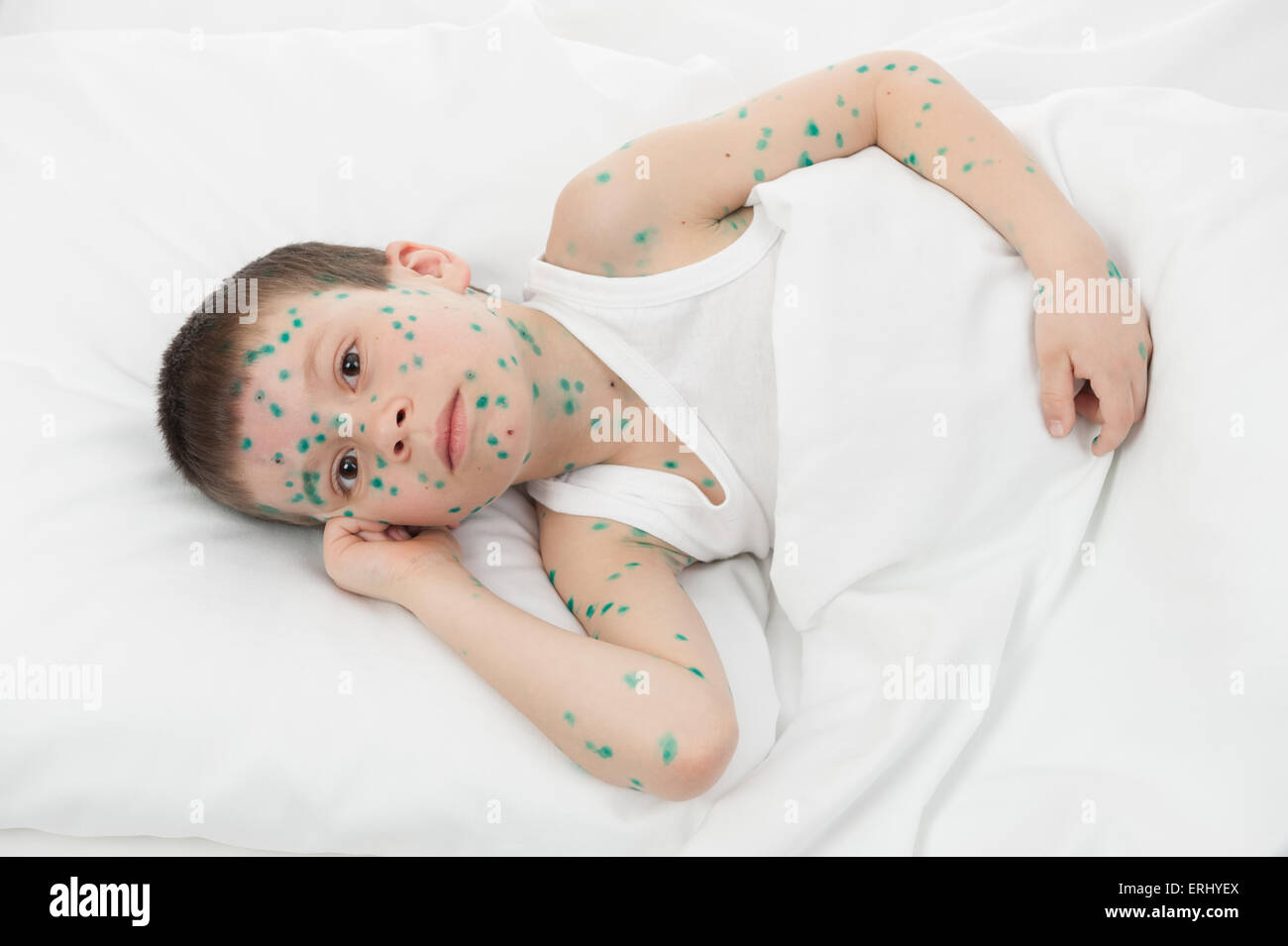 sick boy lying in white bed Stock Photo - Alamy