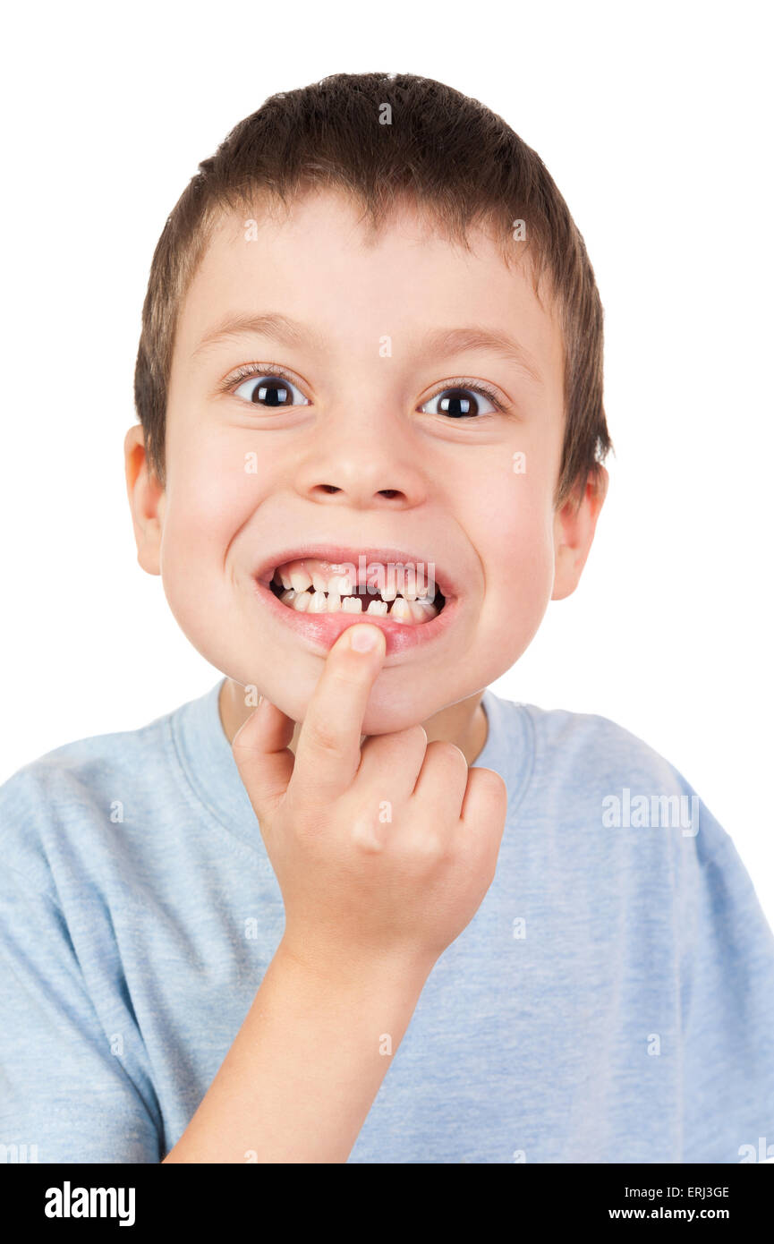 Boy portrait with a lost tooth Stock Photo - Alamy