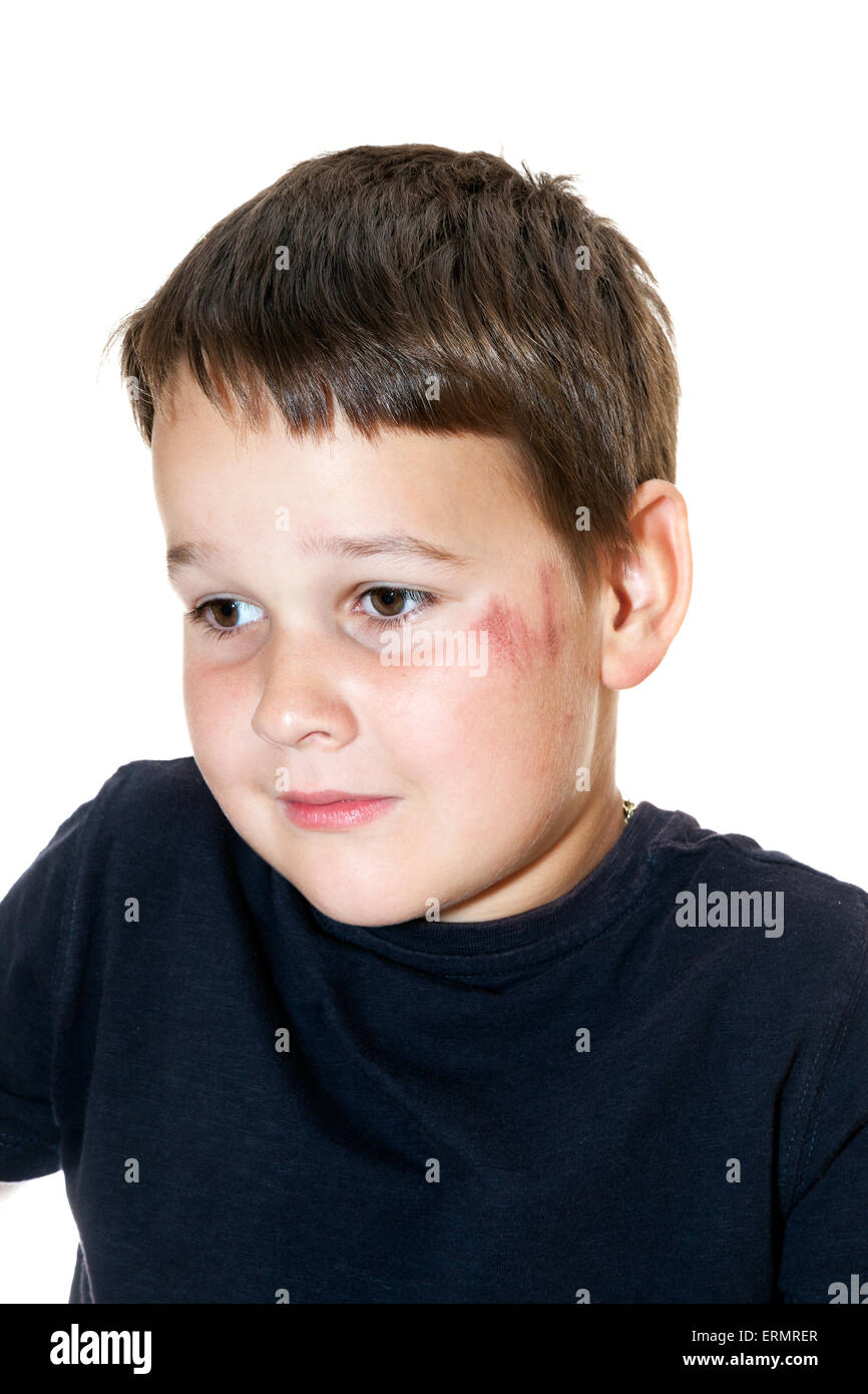 Boy accident hi-res stock photography and images - Alamy