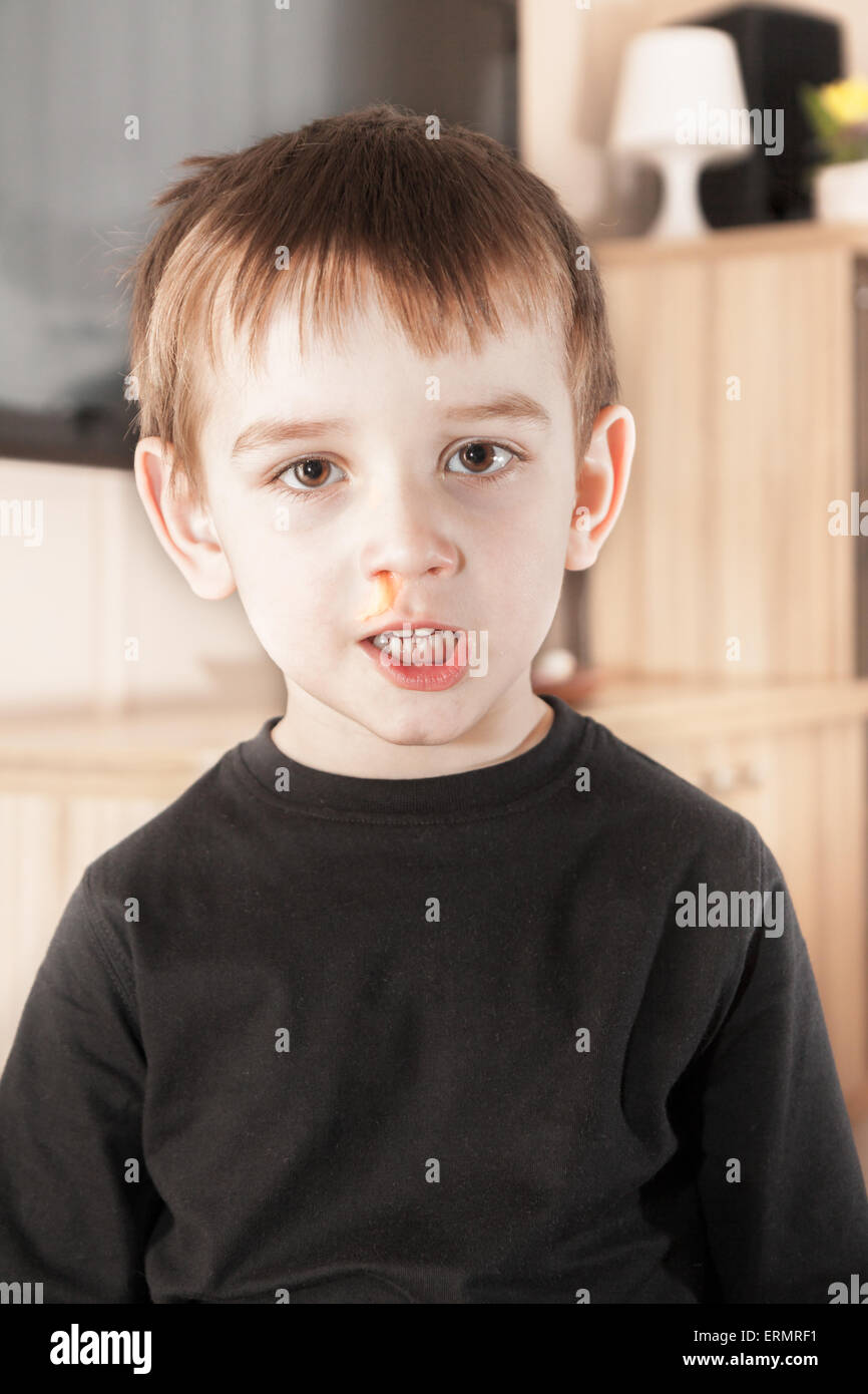 ill boy with flu and green rhinitis at nose Stock Photo - Alamy