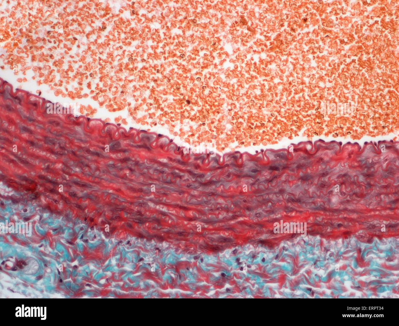 Artery. Light micrograph of a section of a muscular artery. This is the ...
