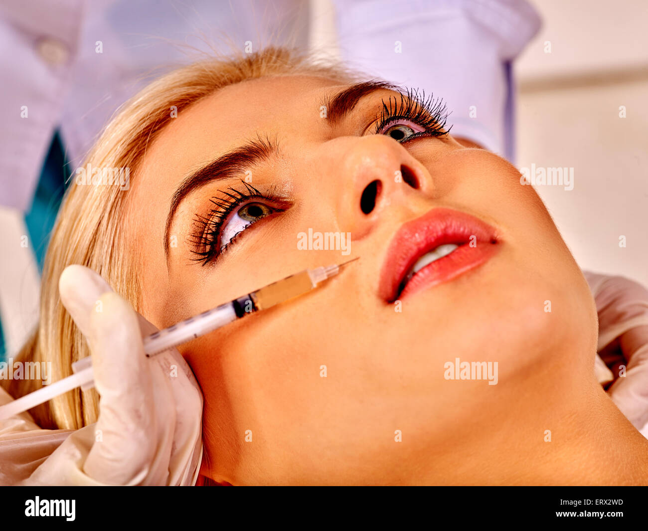 Botox before and after hi-res stock photography and images - Alamy