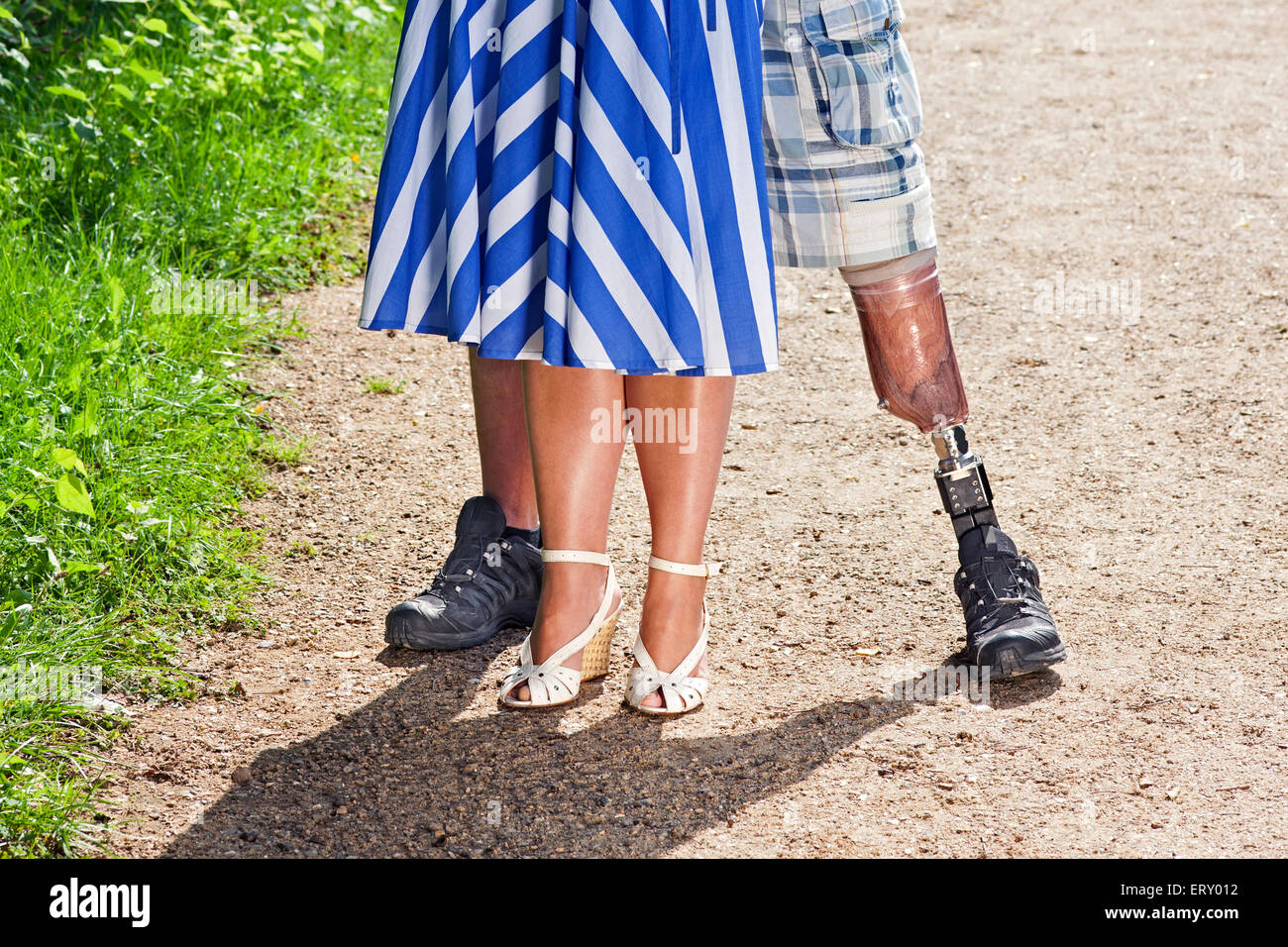 Close up view of the legs of a disabled man wearing a prosthetic leg ...