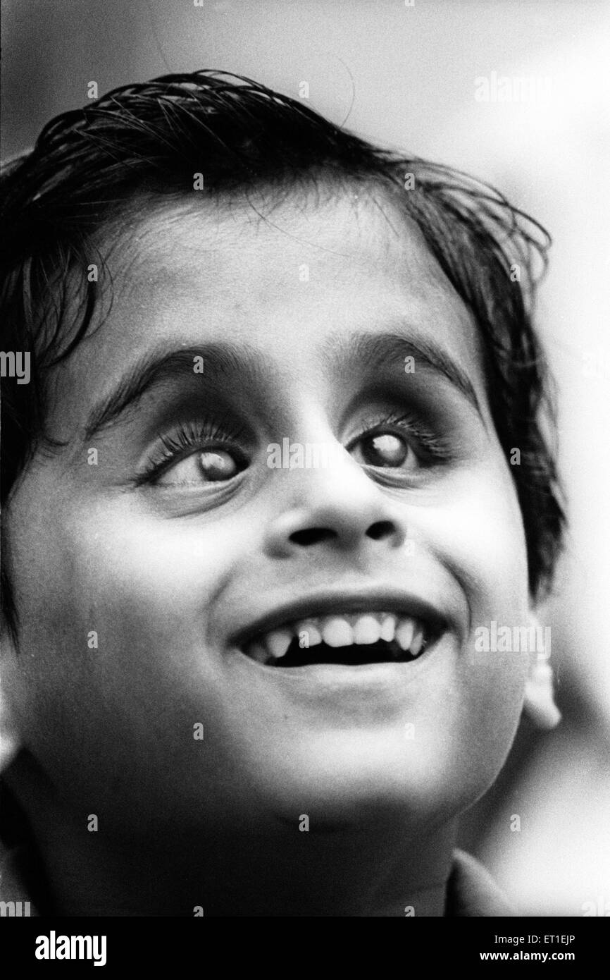 Blind children hi-res stock photography and images - Alamy