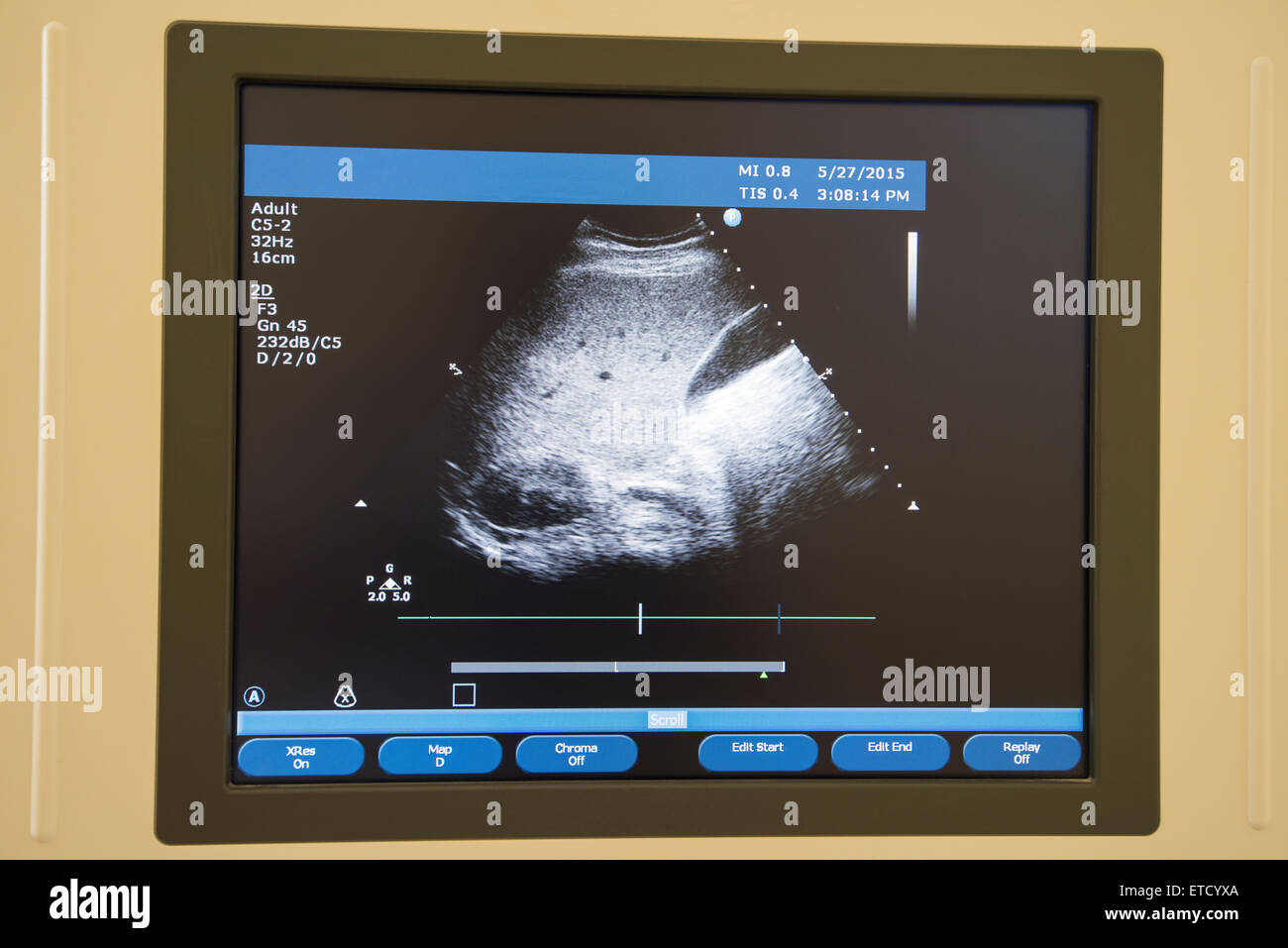 Ultrasound screen High Resolution Stock Photography and Images - Alamy