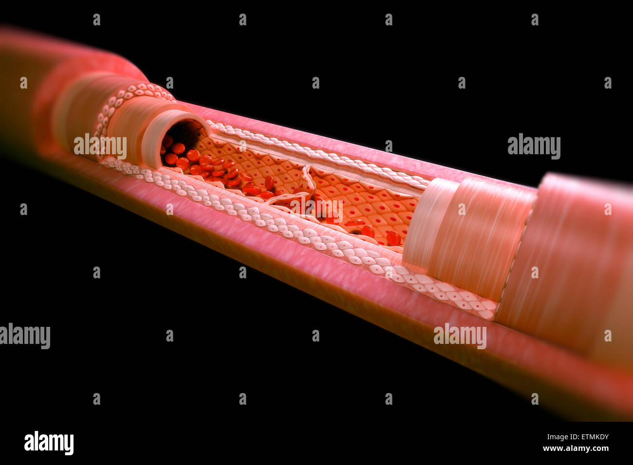 Endothelium subendothelial layer hi-res stock photography and images ...