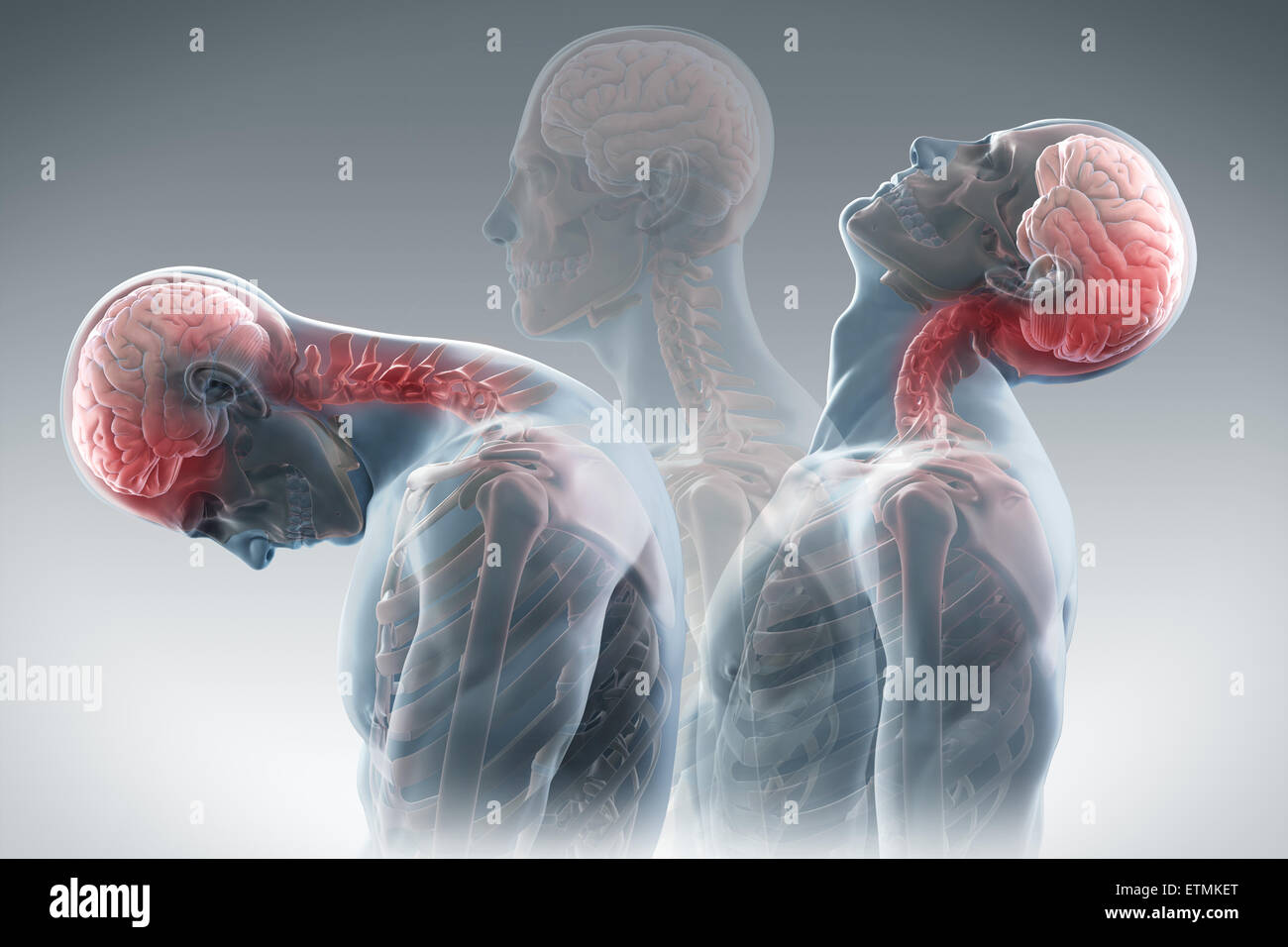 Also whiplash hi-res stock photography and images - Alamy