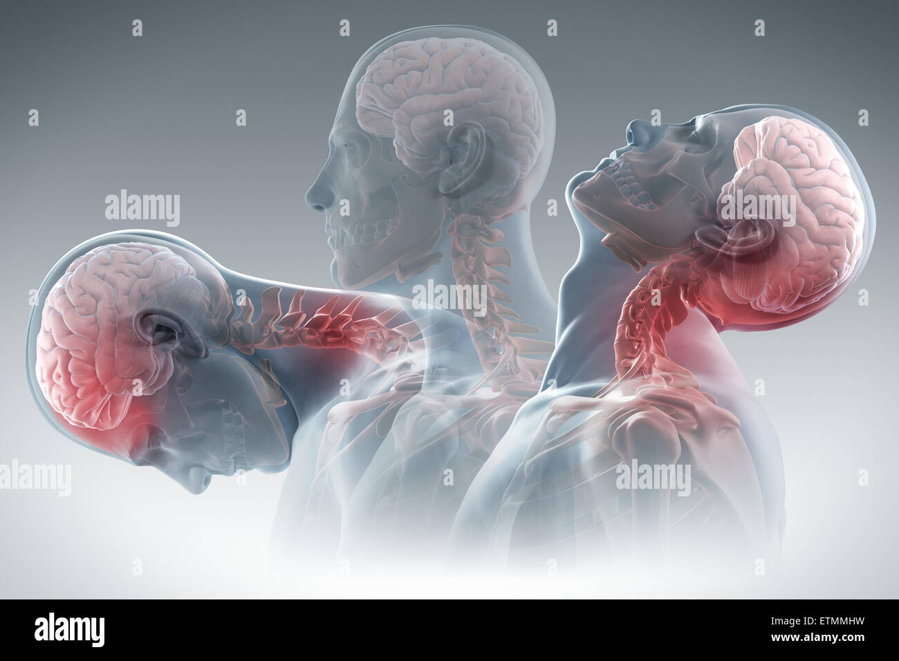 Conceptual illustration showing the stages of motion that cause ...