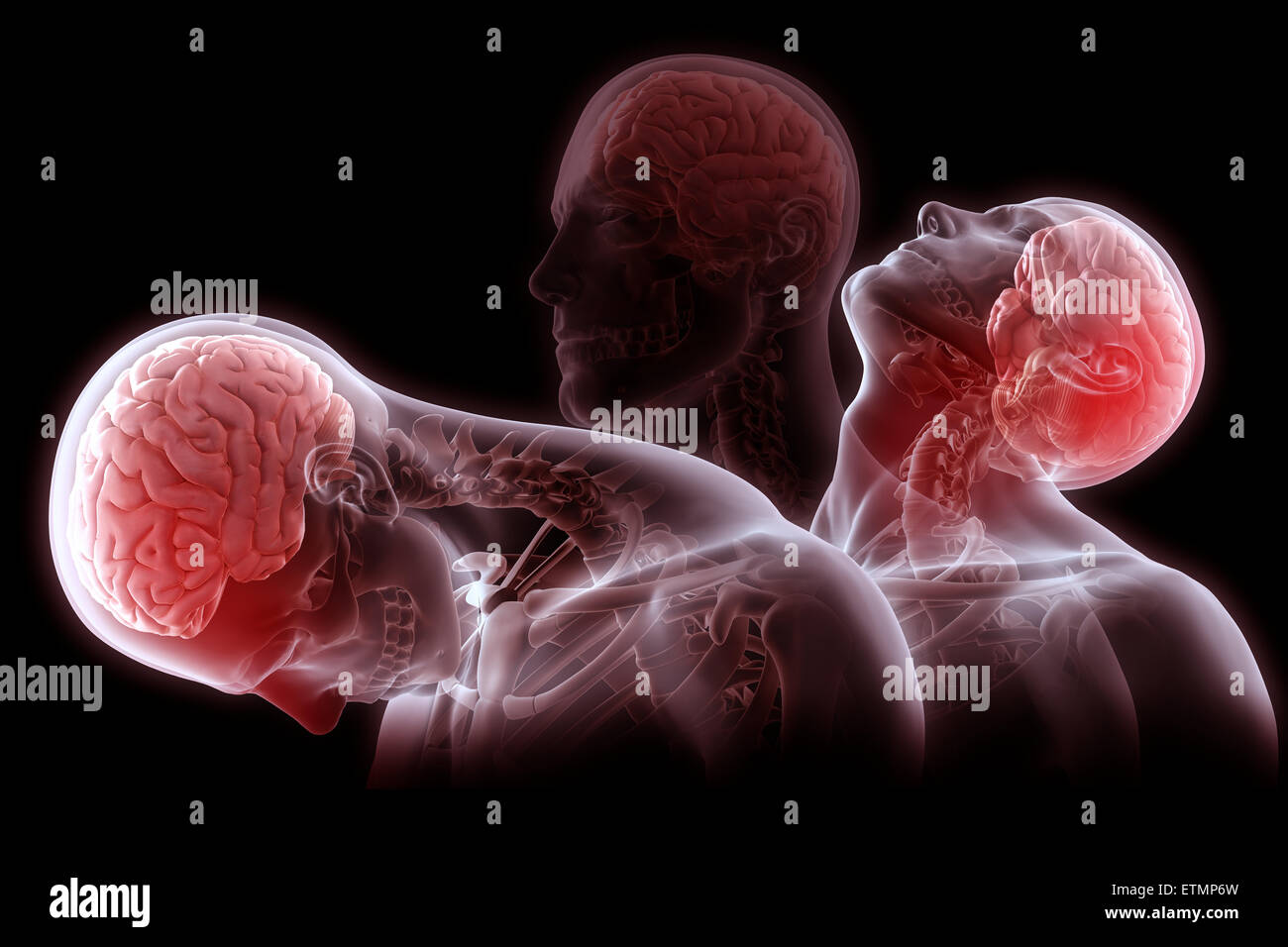 Conceptual illustration showing the stages of motion that cause ...