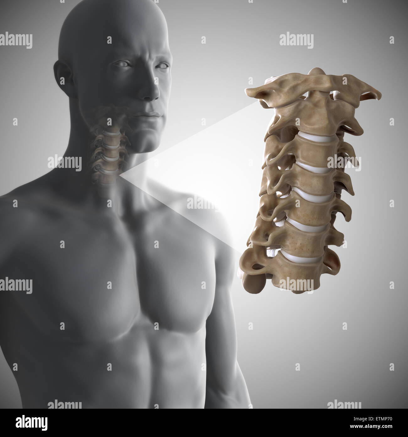 Stylized illustration showing the vertebrae of the neck in situ, with a ...