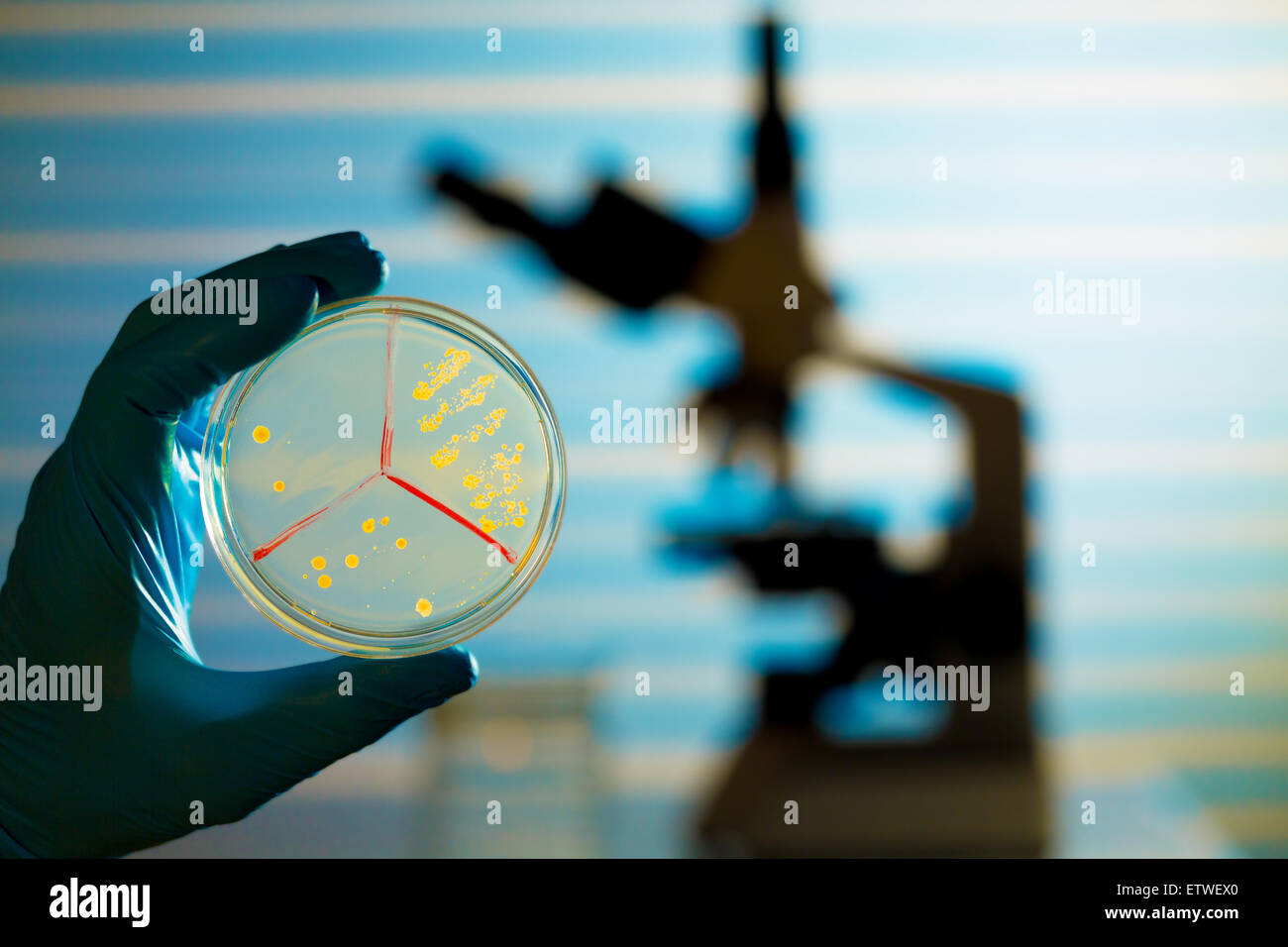 Petri dish in hand and microscope on laboratory background Stock Photo ...