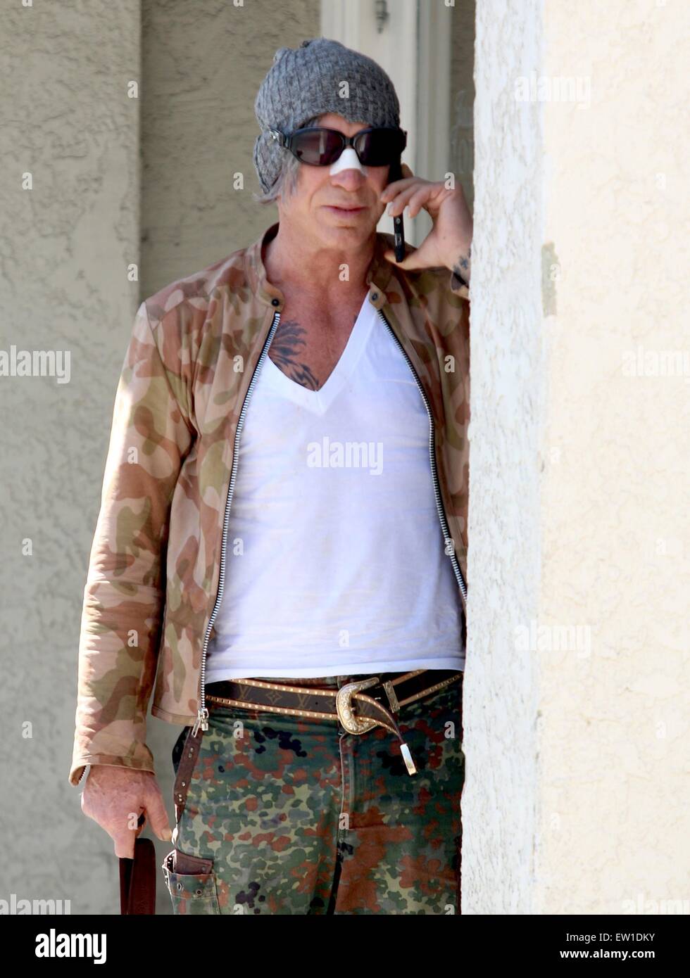 Mickey Rourke seen on Brighton Way in Beverly Hills with a bandage on ...
