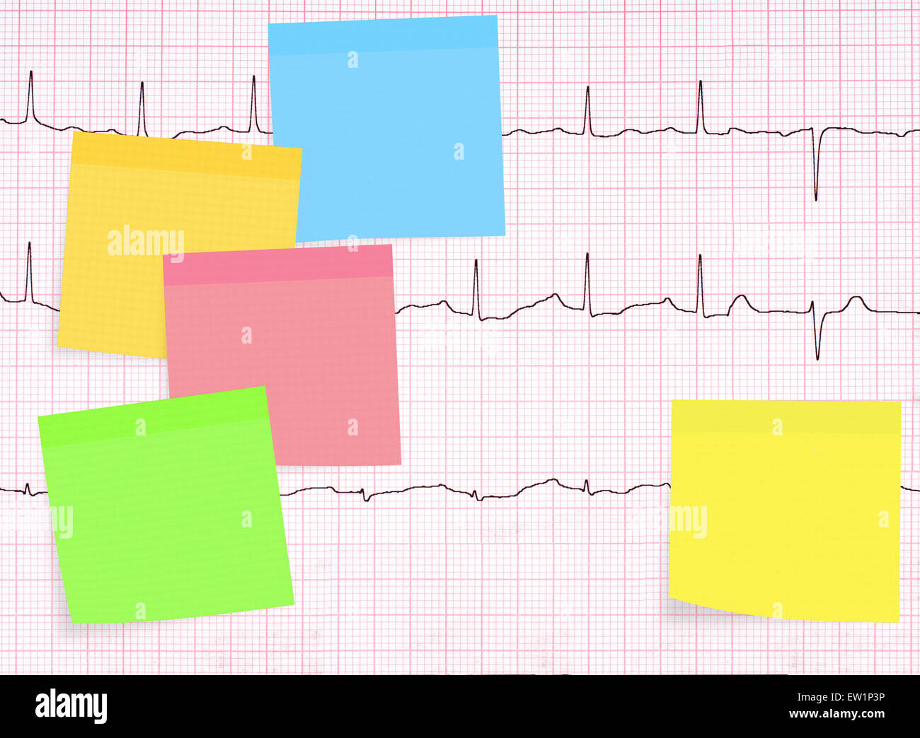 Healthy heart background. ECG, electrocardiogram detail with postit ...