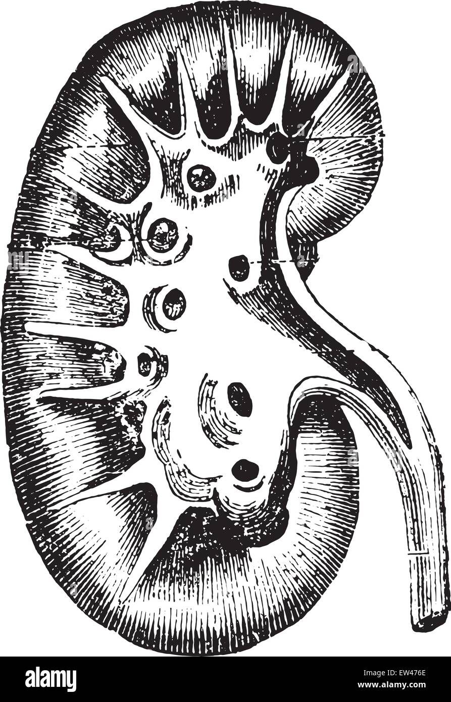 Vertical section of the kidney, vintage engraved illustration Stock ...