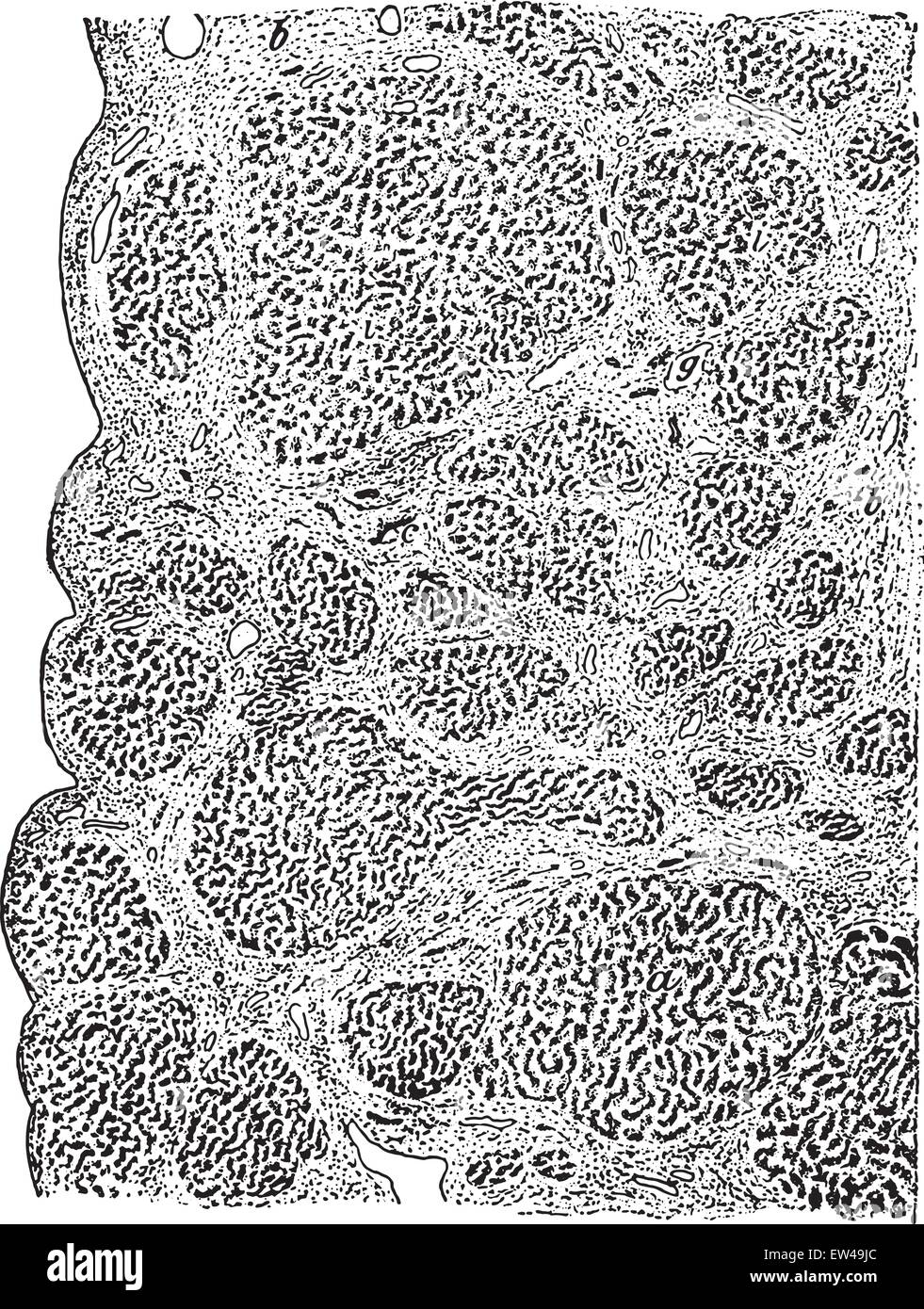 Liver cirrhosis drawing hi-res stock photography and images - Alamy