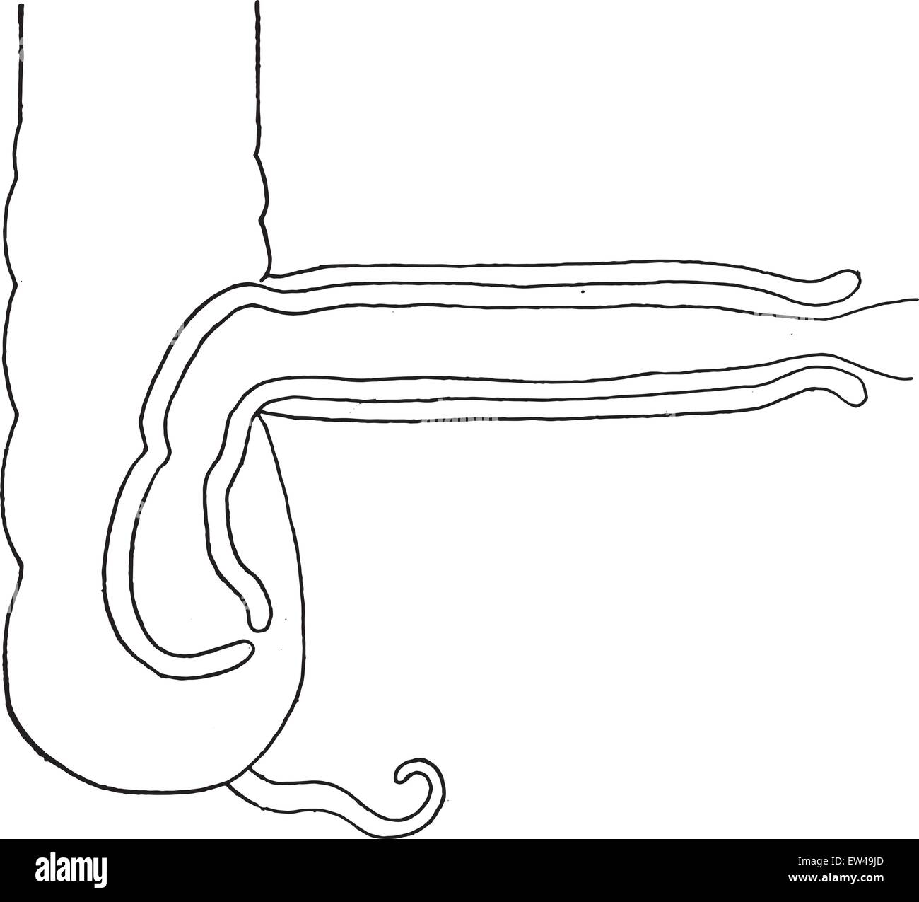Intussusception diagram intended to show the relation of the several ...