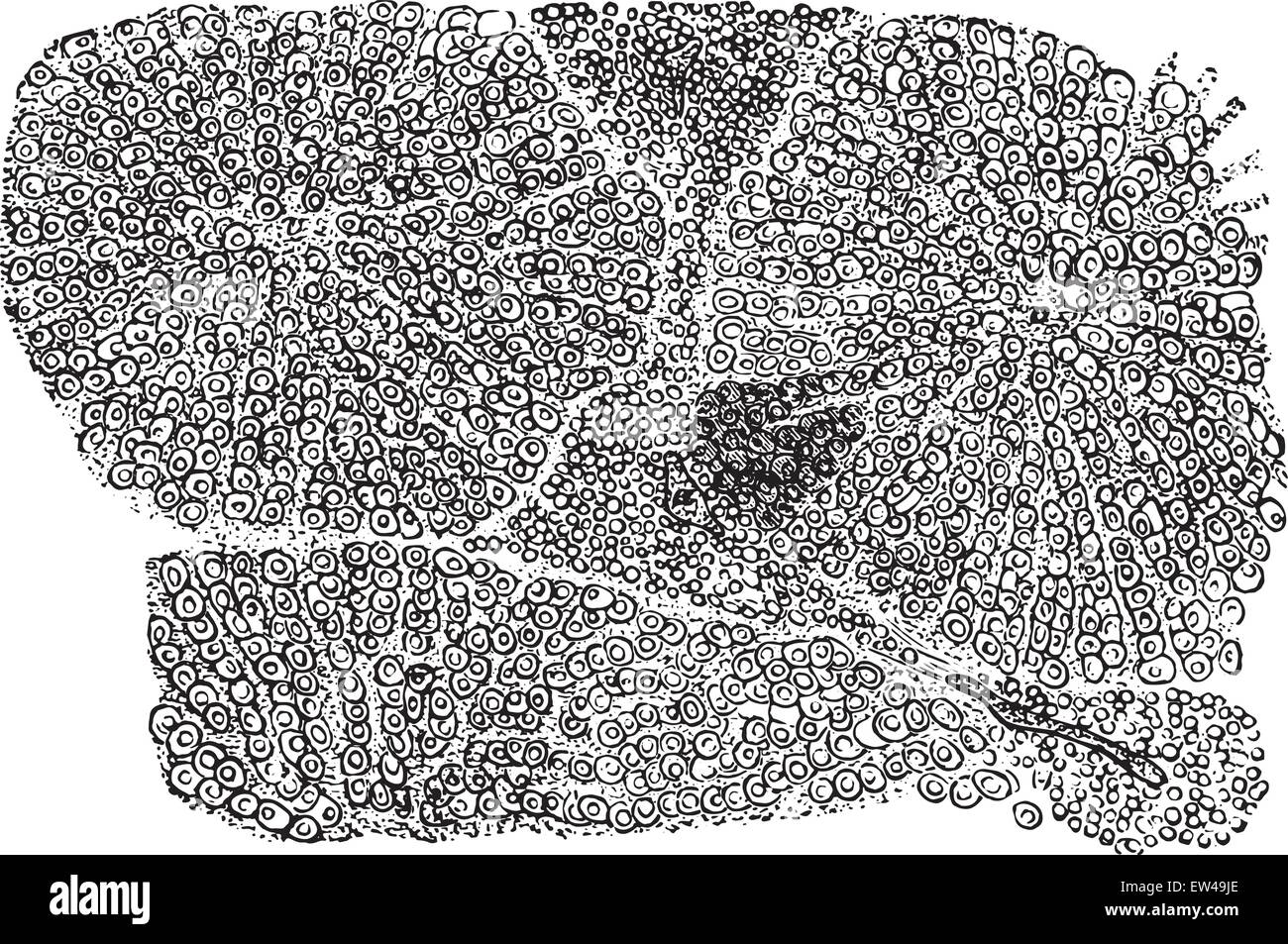 Liver cirrhosis drawing hi-res stock photography and images - Alamy