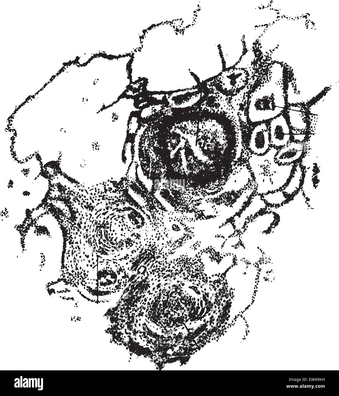 Tuberculosis drawing hi-res stock photography and images - Alamy