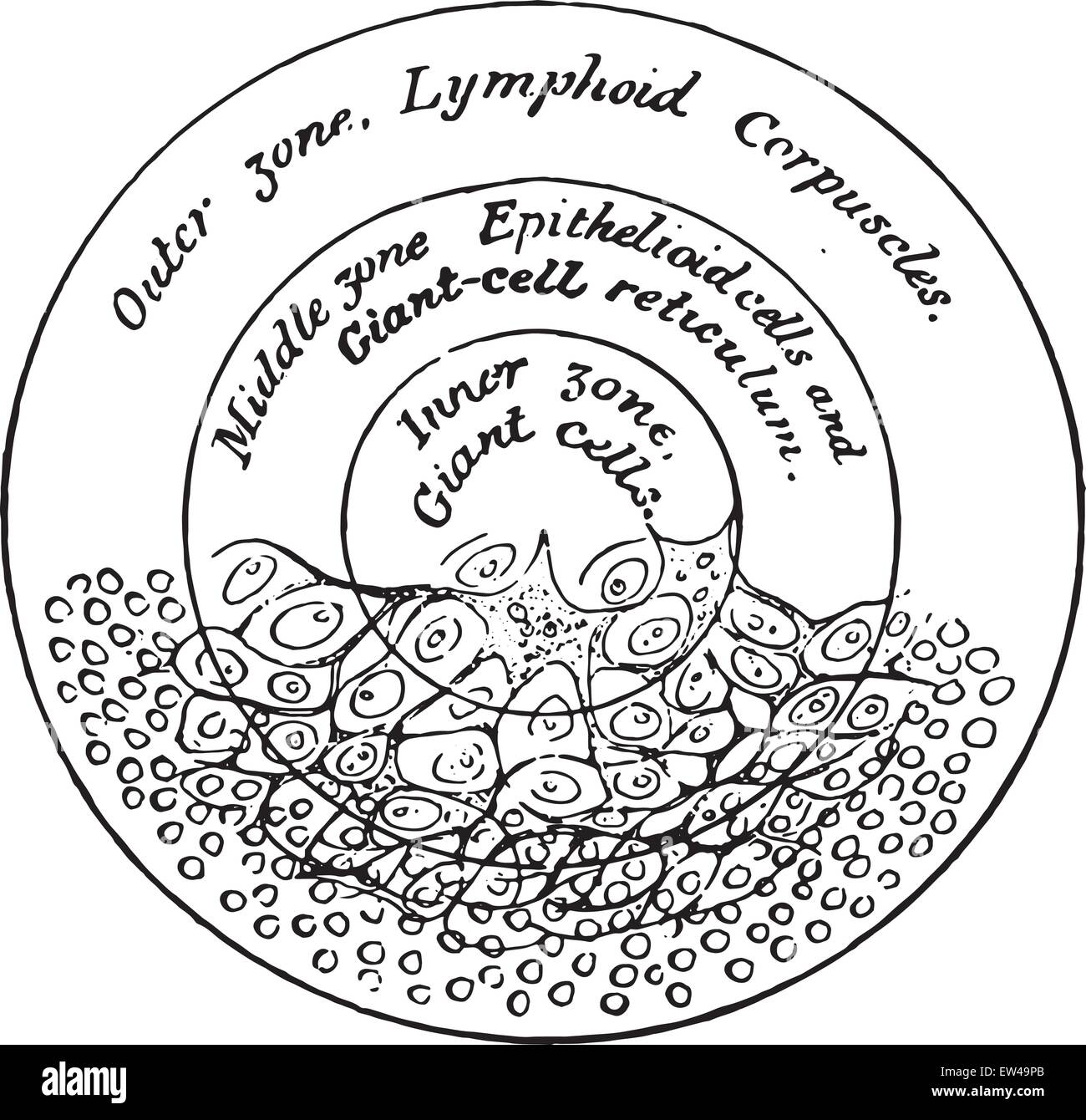 Tubercle structure hi-res stock photography and images - Alamy