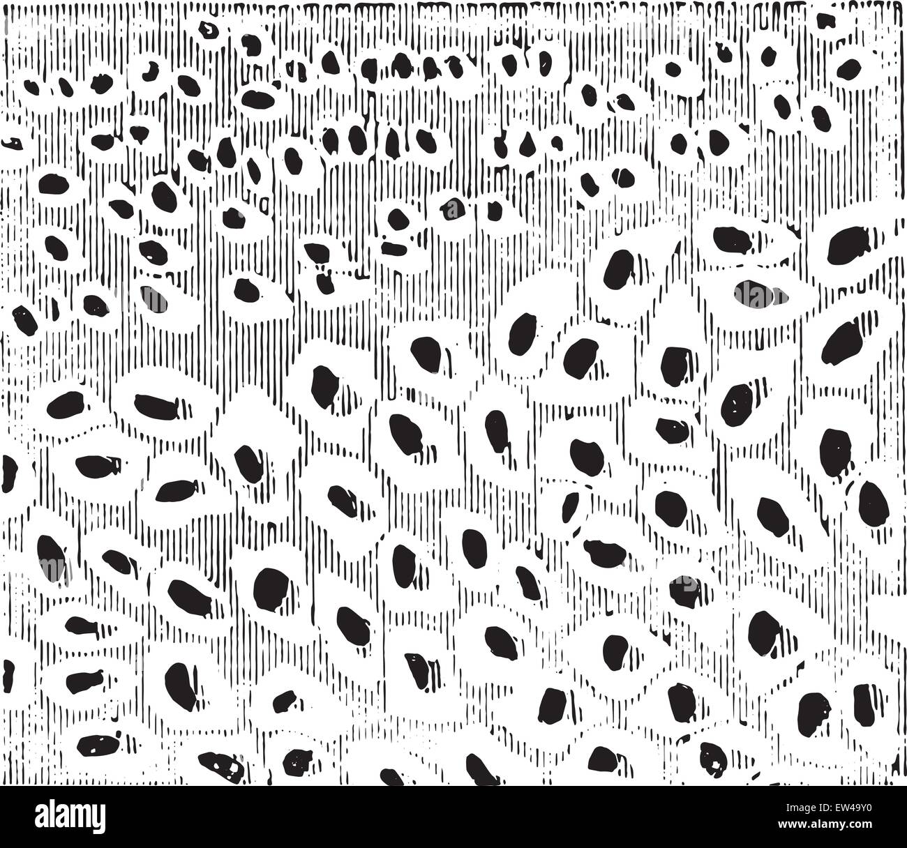 Chondroma, vintage engraved illustration Stock Vector Image & Art - Alamy