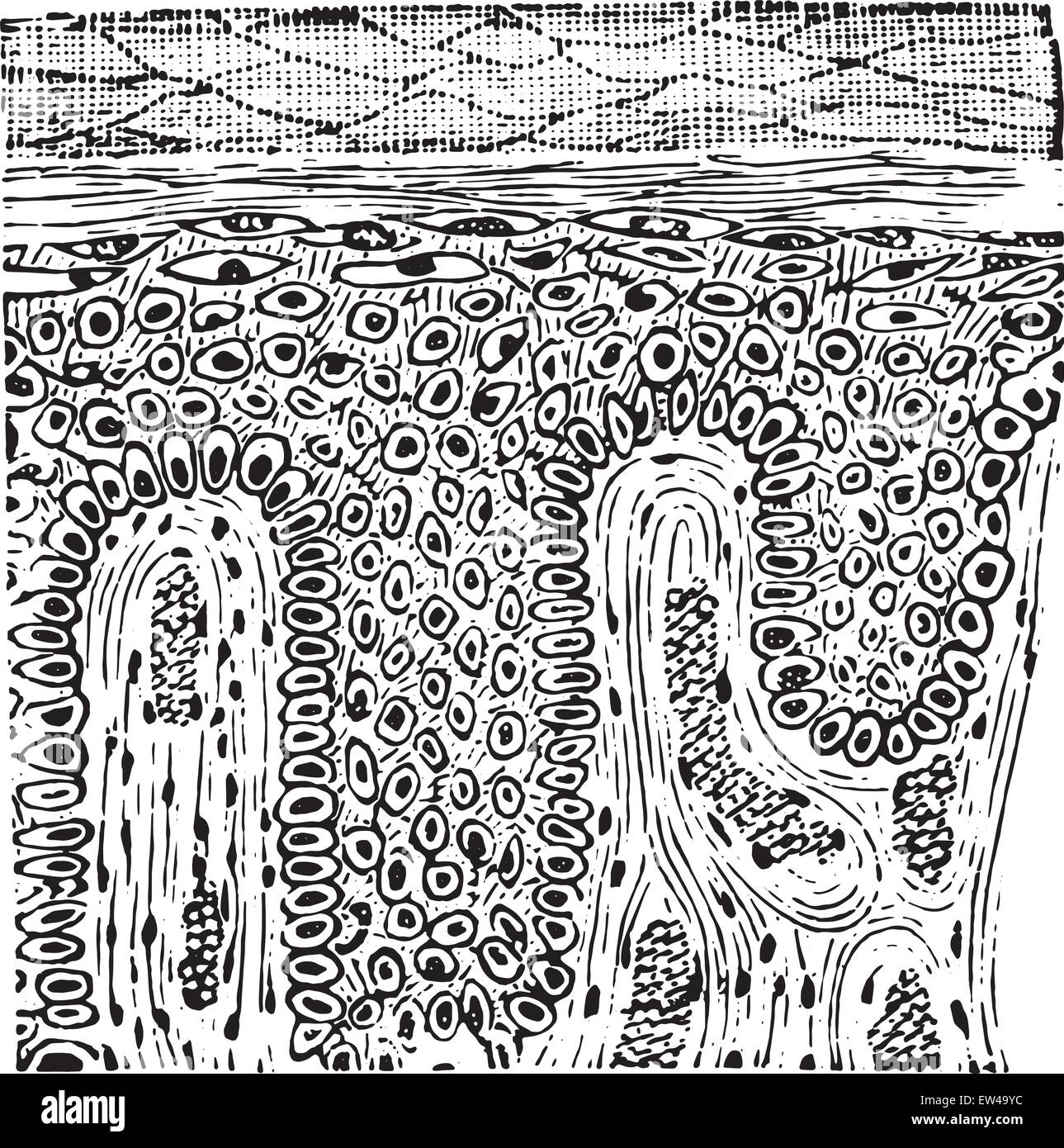 Squamous epithelioma hi-res stock photography and images - Alamy