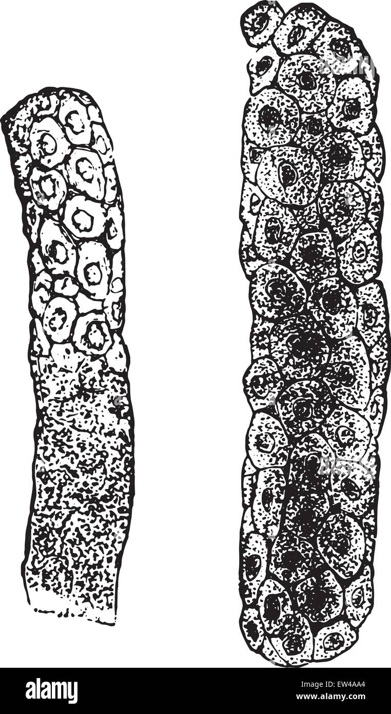 Epithelial tissue hi-res stock photography and images - Alamy