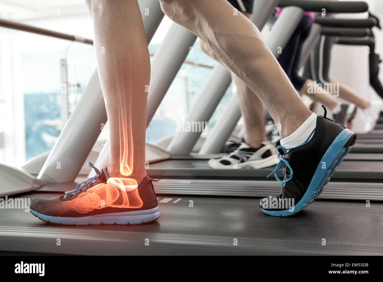 Highlighted bones of man on treadmill Stock Photo - Alamy