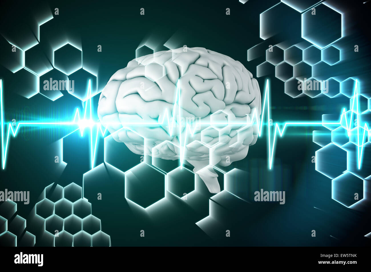 Brain Electrode High Resolution Stock Photography and Images - Alamy