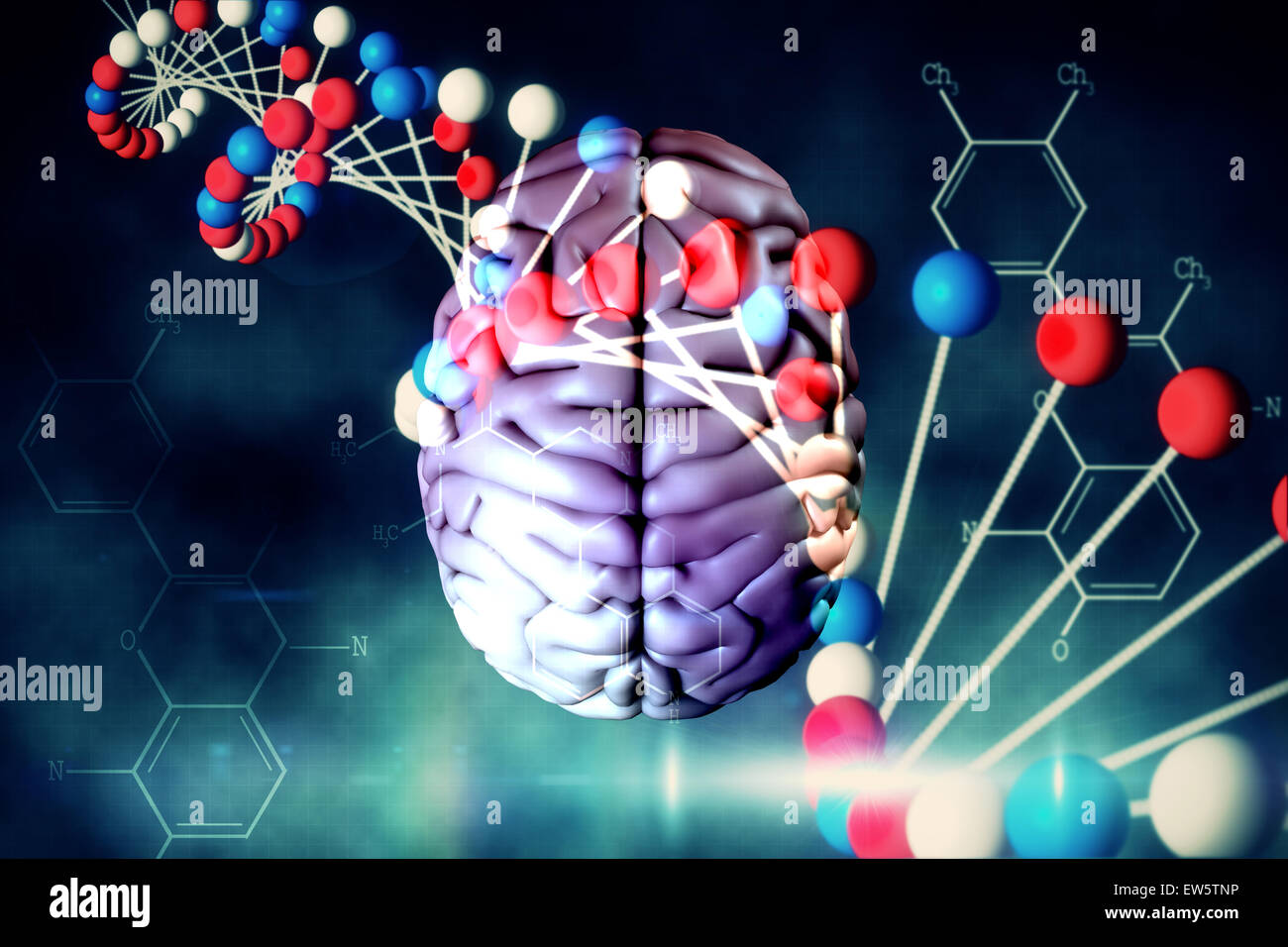 Electrode brain hi-res stock photography and images - Alamy