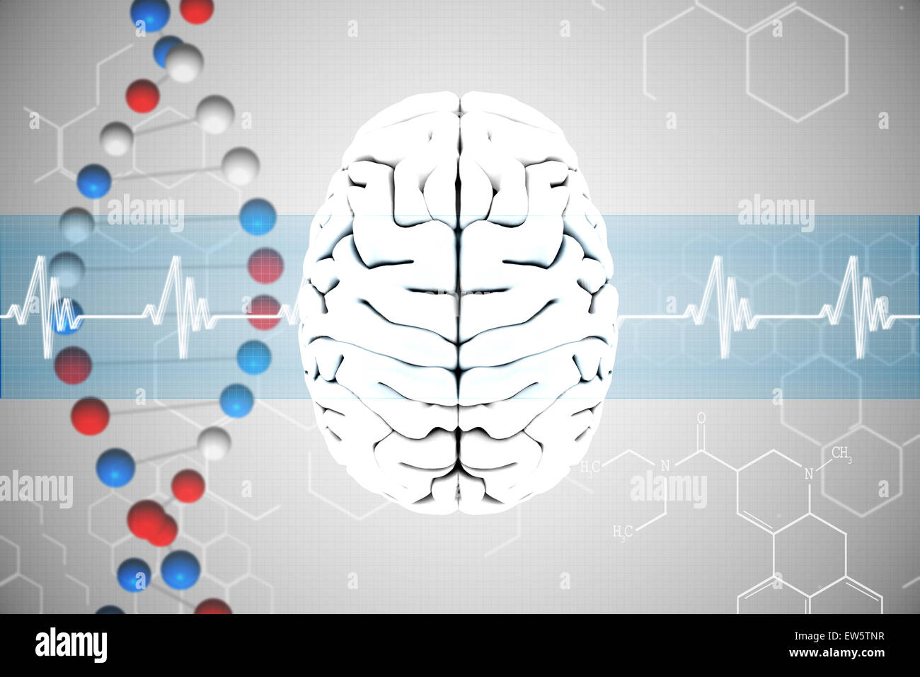Electrode brain hi-res stock photography and images - Alamy