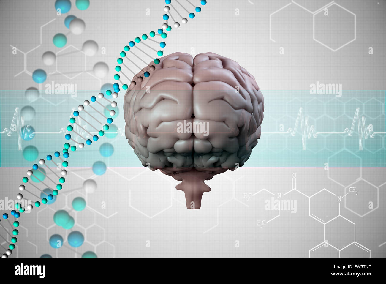 Electrode brain hi-res stock photography and images - Alamy