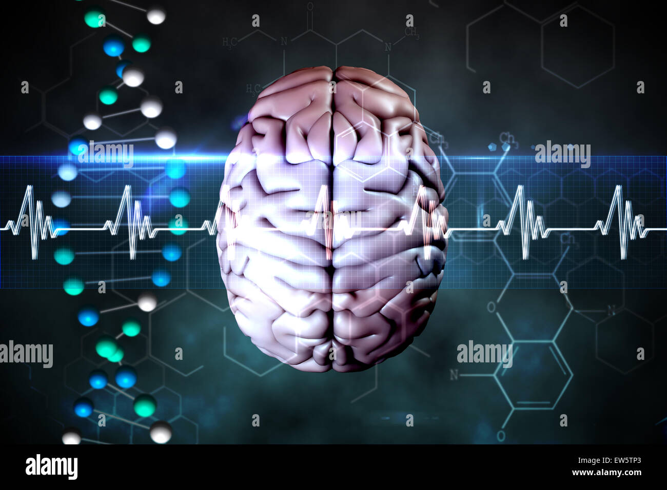 Electrode brain hi-res stock photography and images - Alamy