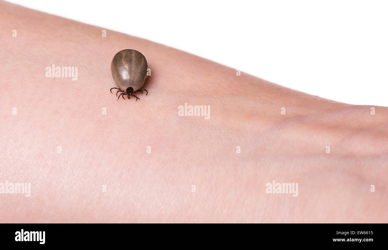 Tick crawling on a human skin Stock Photo - Alamy