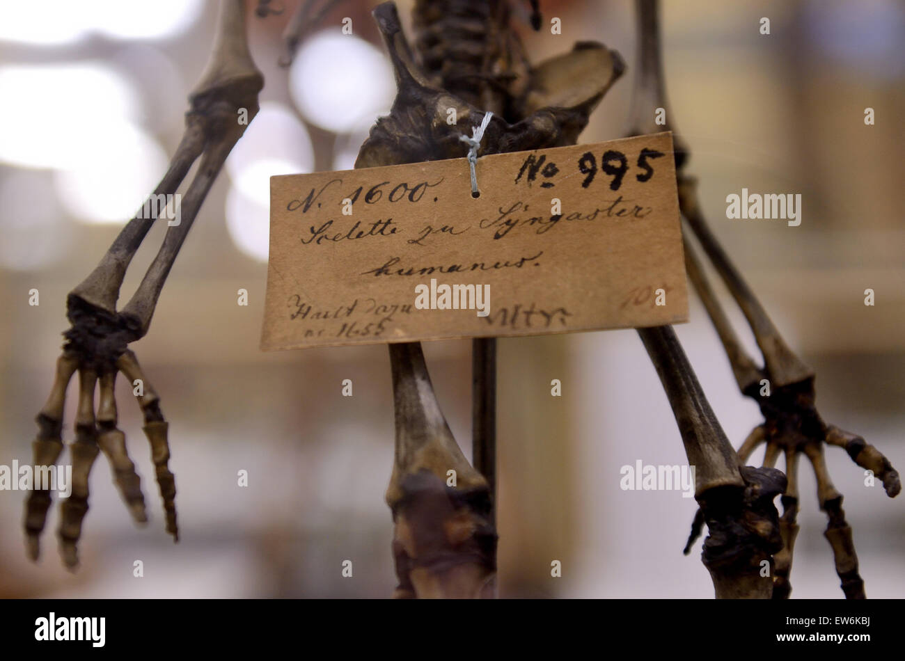 A historic label marks the skeleton of a child in the 'Meckelsche ...