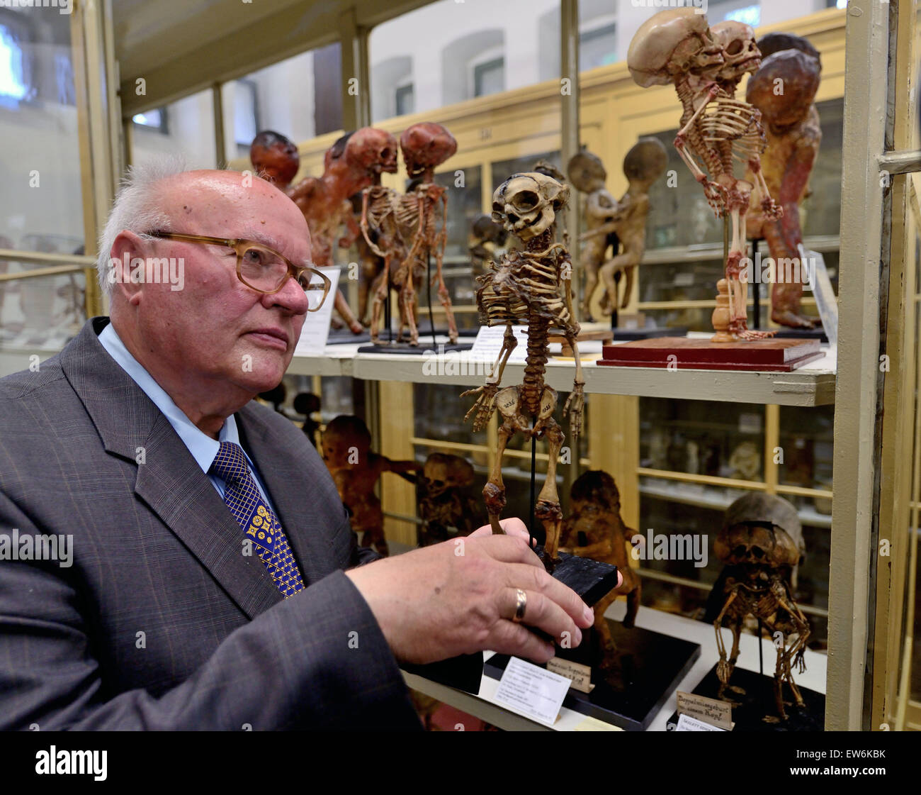 Anatomy professor Ruediger Schultka looks the skeleton of a child with ...