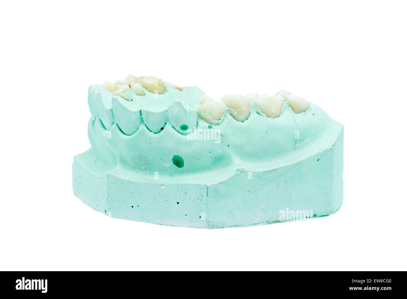 Denture cast model isolated on white background Stock Photo - Alamy