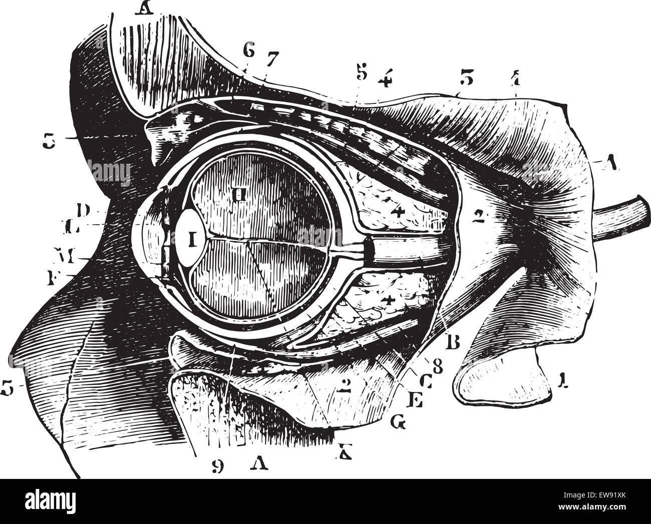 Anterior chamber lens hi-res stock photography and images - Alamy