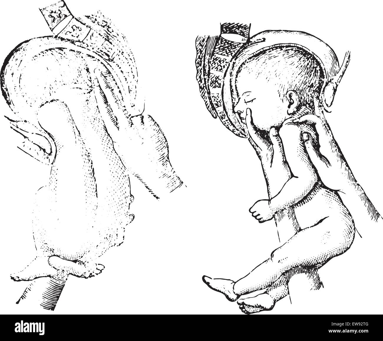 Cephalic position Stock Vector Images - Alamy